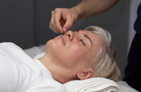 Mastering Efficiency: Acupuncture Billing Services Guide