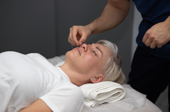 The Essential Guide to Acupuncture Billing Services